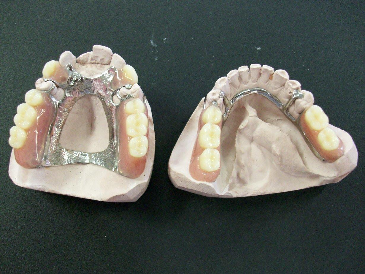 Akikcadcamprosthetics