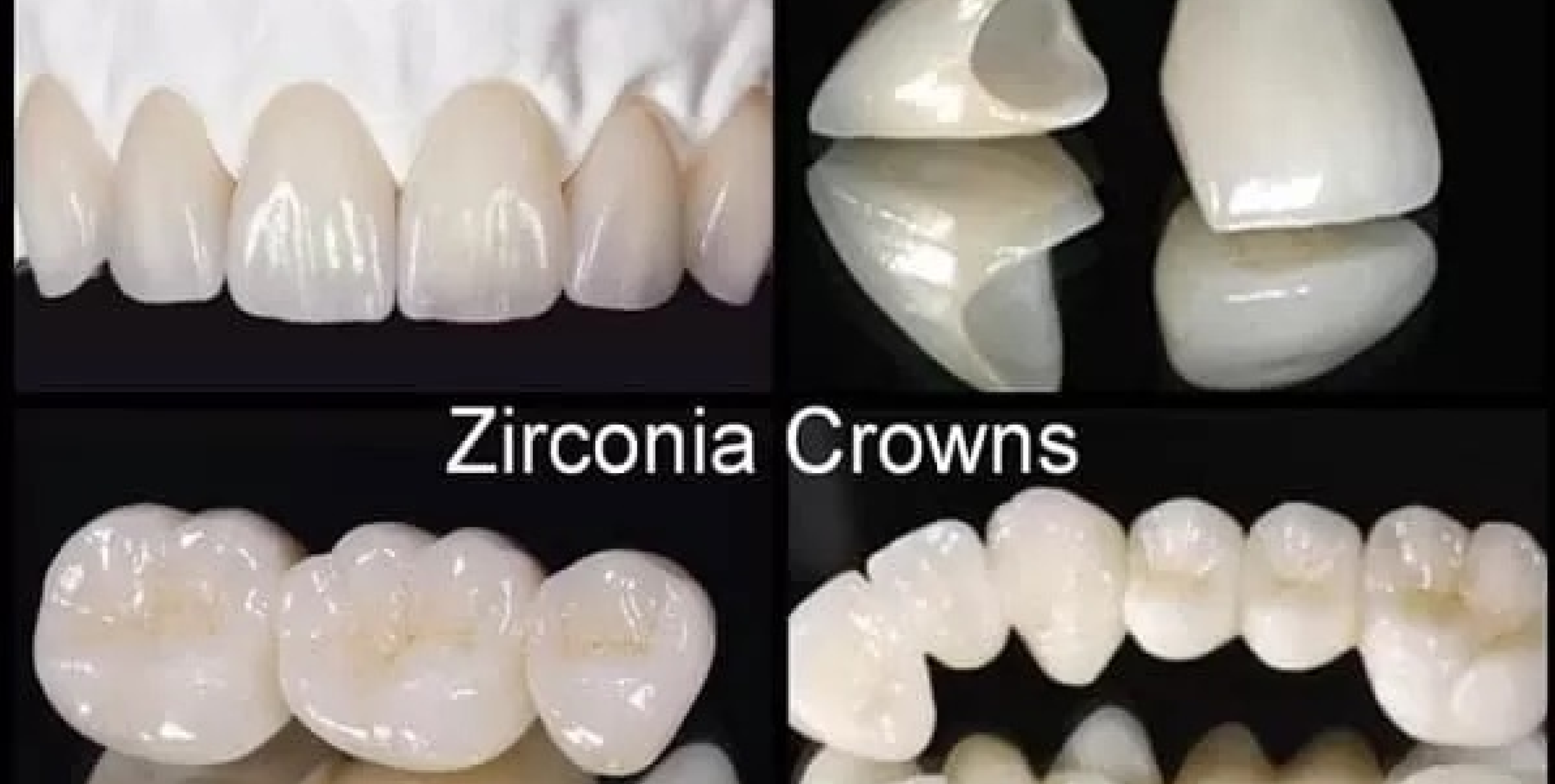 Akikcadcamprosthetics